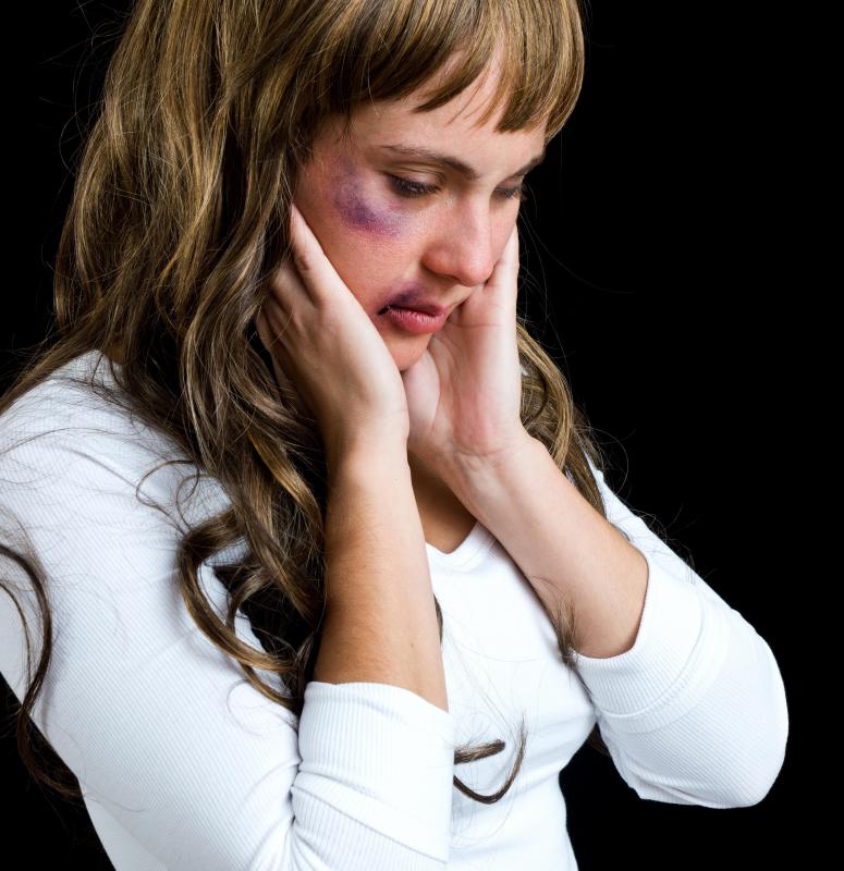 What is Learned Helplessness? (with pictures)